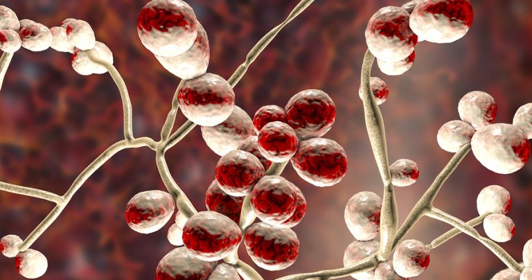 Candida & Natural Health Remedies | Baseline of Health Foundation